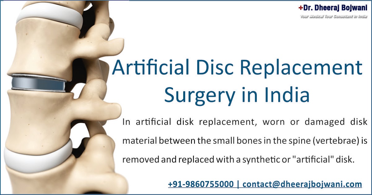 Top Spine Surgeons Speak Out About Artificial Disc Replacement Surgery