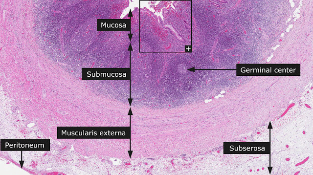 Scientia potentia est: Human Appendix could have an important ...