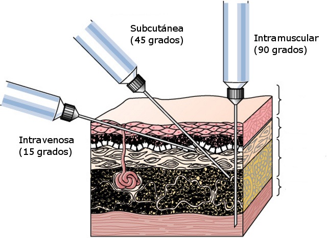 "VIGIAR" Vigilância em Saúde : Curiosidade: Injeção, agulhas? Qual usar