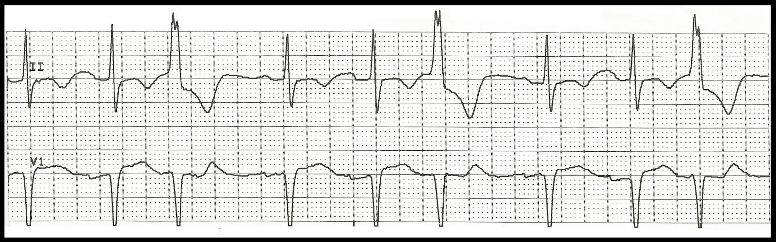 EKG Rhythm Strip Quiz 127
