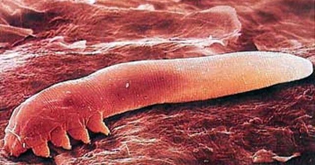 Le Demodex : l'acarien à la malformation anatomique embarrassante ...