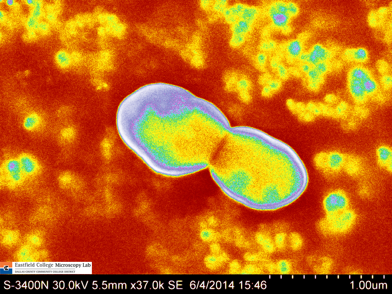 Scanning Electron Microscope Blog: Imaging Bacteria in the Scanning ...