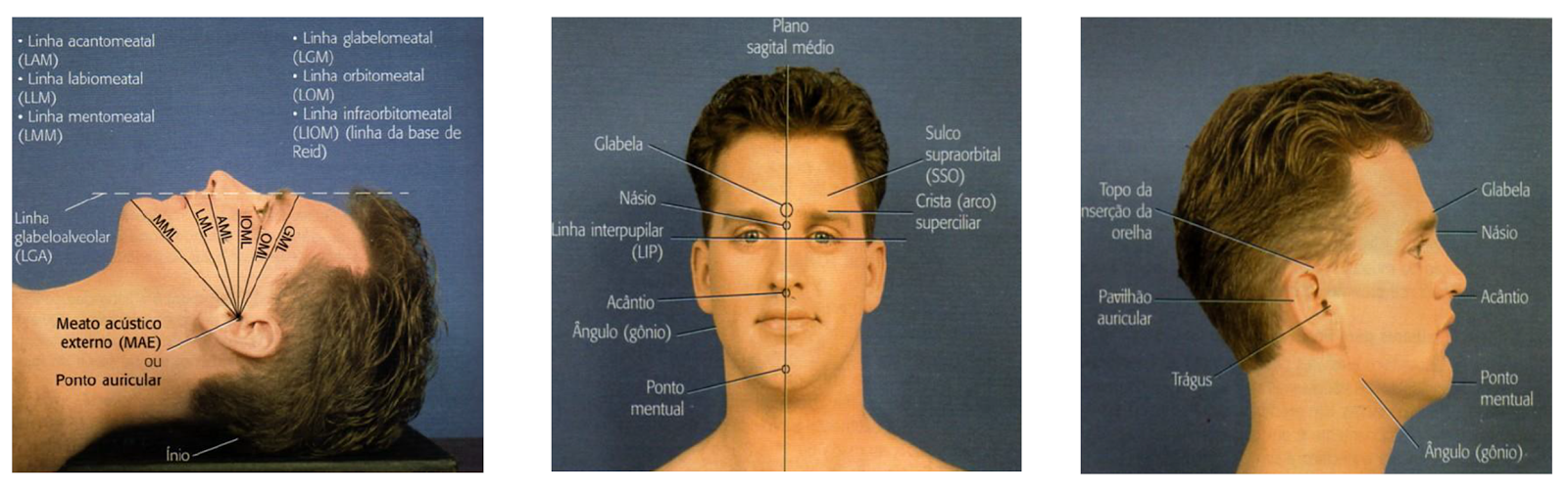 Laboratório de Roentgen: Crânio e Face
