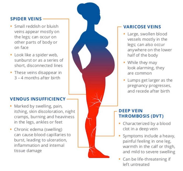 peaceful parenting: Baby Strains on Your Veins