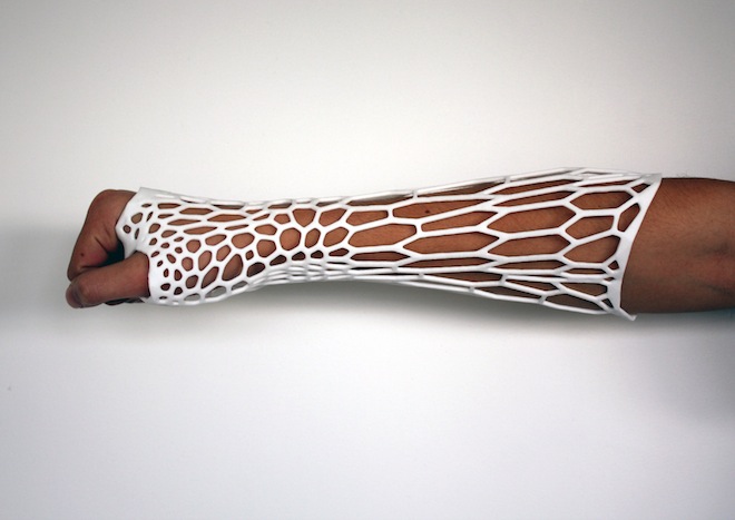 Generative Design Workflow & Reality Computing for Leg Casts: Weekly ...