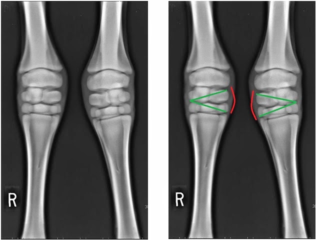 Desviaciones Articulares en los potros ``Carpus Varus´´