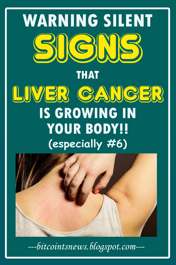 8 Silent Signs Of Liver Cancer You Should Not Ignore