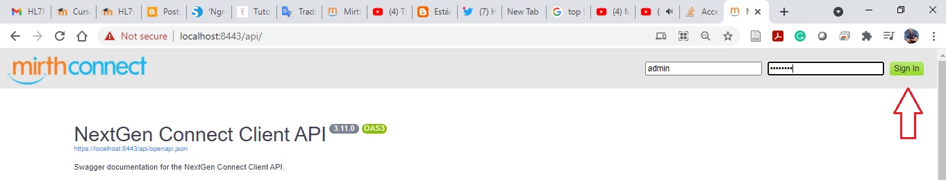 Setup de una REST API en Mirth Connect