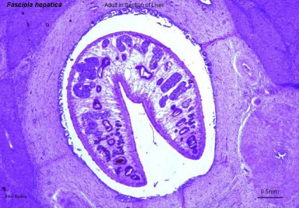RIZNICA LEKOVITOG BILjA: PARAZITI U LjUDSKOM ORGANIZMU I KAKO SE IZLEČITI