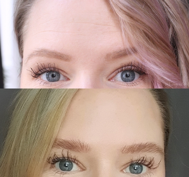 ♥ In Love With Life ♥: Stirnfalten adé..!? Meine Botox-Erfahrung | Teil ...