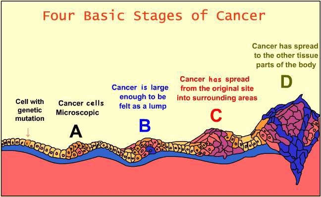 Project on cancer biology/oncology for class 12th