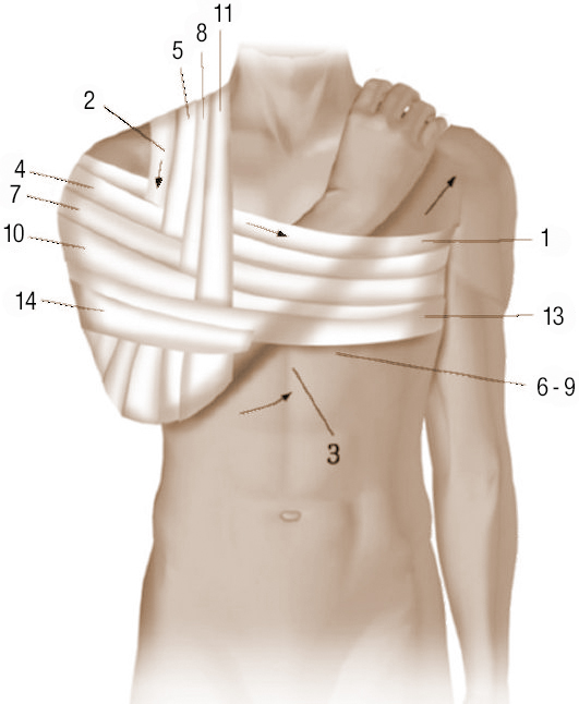 ATENSALUD: Enfermaría Geriátrica y Sociosanitaria: Técnicas de Vendaje