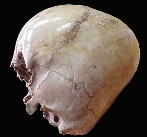 You Want To Know?: RARE SKULL: STARCHILD