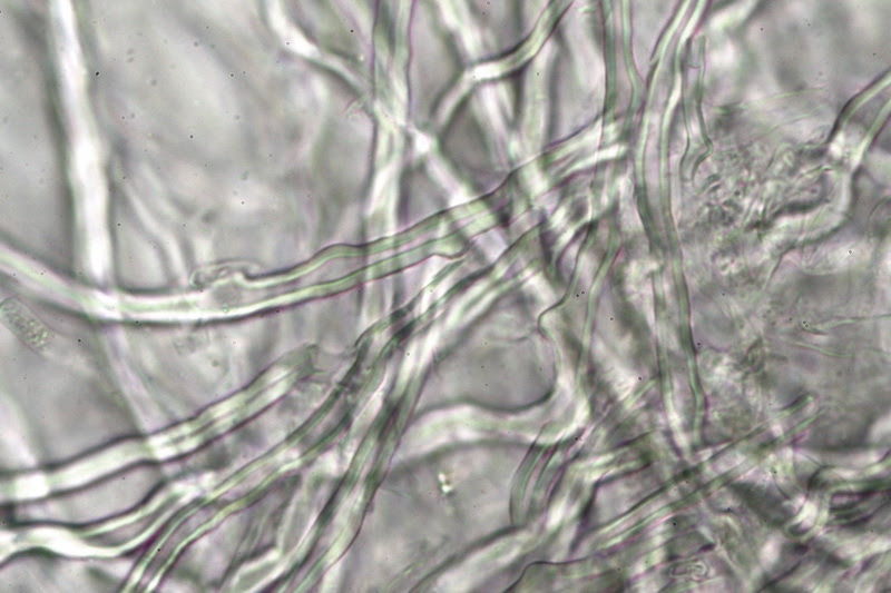 El mundo microscópico de los hongos: Polyporus tuberaster Pers.ex Fr.