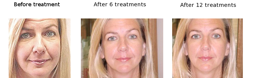 barebodiesbynina: Microcurrent Facials