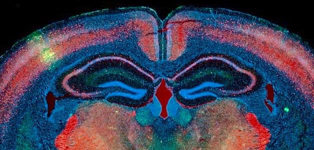 Our Parkinson's Place: Postdoctoral researchers and students shine at ...