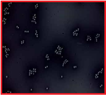Negatively Stained Cocci