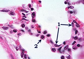 Anatomia patológica: Tema 1 . Histologia del aparato respiratorio