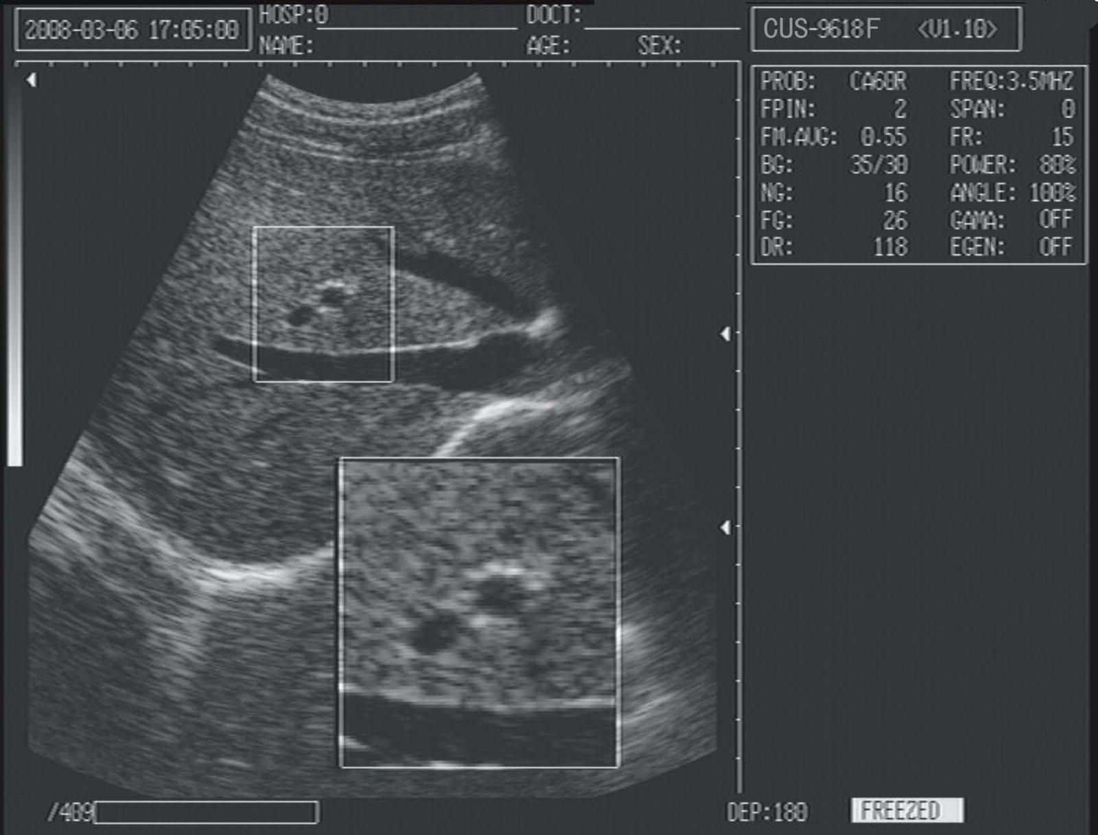 Ultrasonografia El Salvador