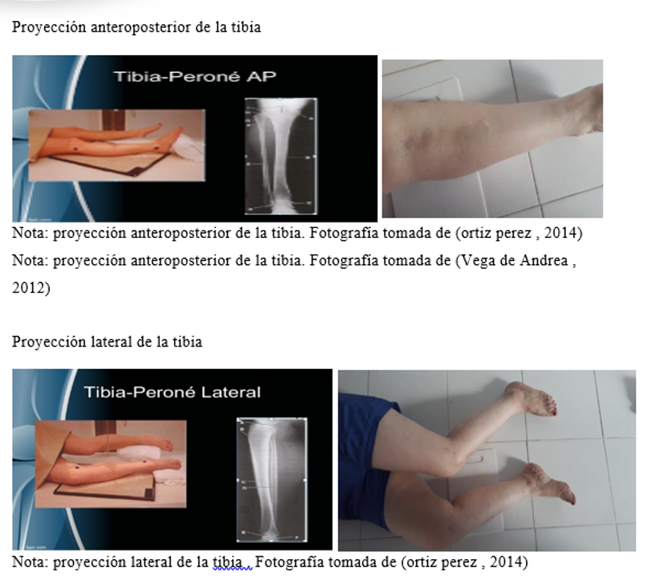 CREACION DE PROTOCOLOS : ESTUDIOS RADIOGRAFICOS MIEMBROS INFERIORES