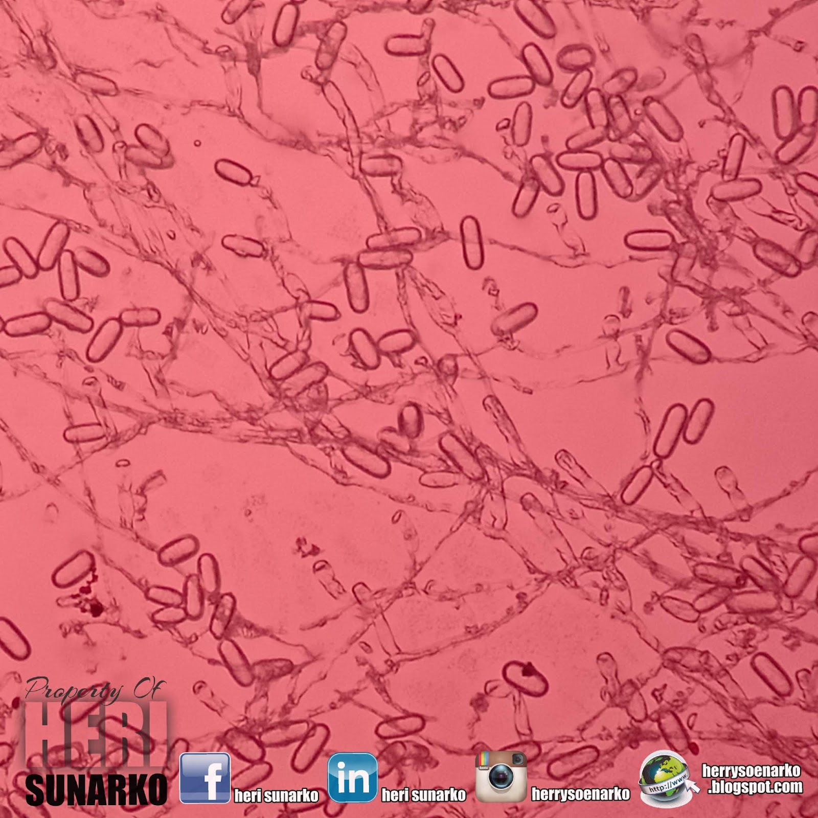 Embun Tepung (Powdery Mildew) pada Tanaman Hutan Industri