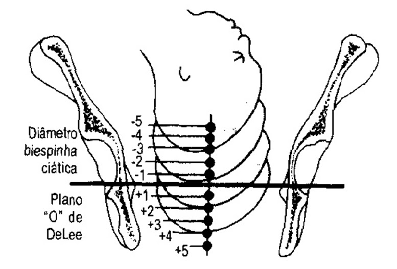 Estudo de Enfermagem: Estática Fetal