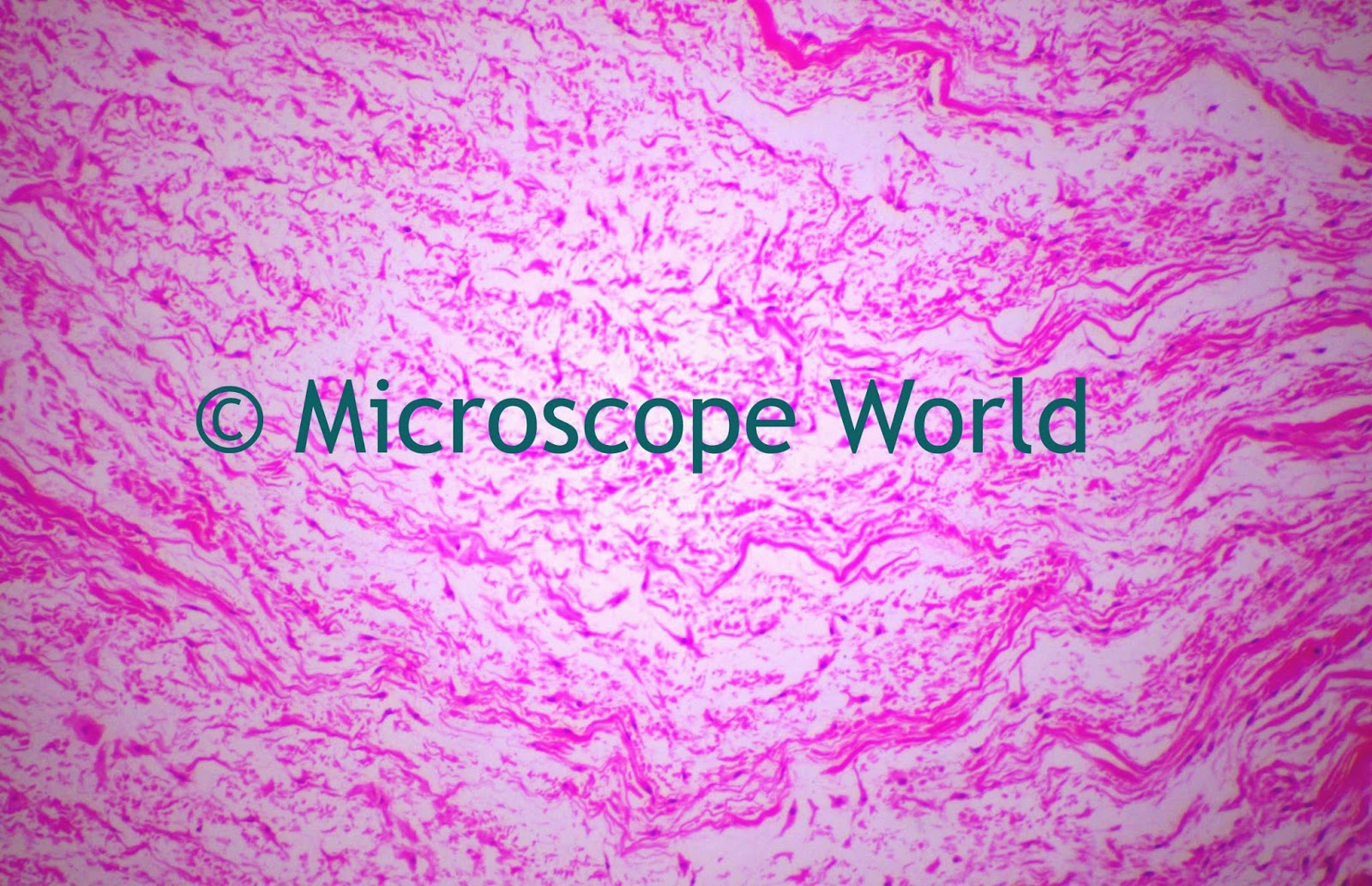Microscope World Blog: Tendons under Microscope
