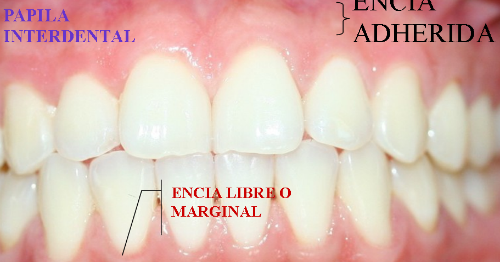 Facultad de Estomatologia: Tipos de encía