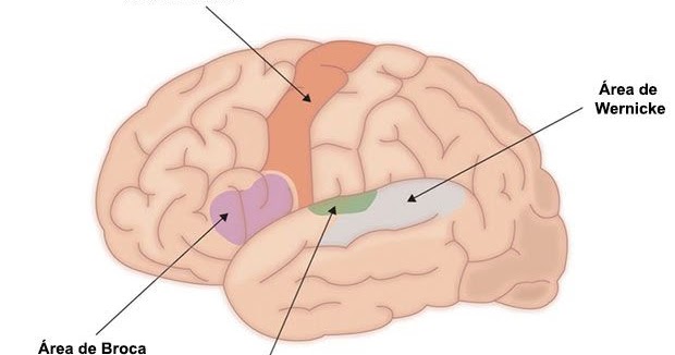 Afasia de Broca