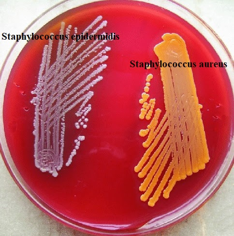 Answer to Case 2: Staphylococcus aureus