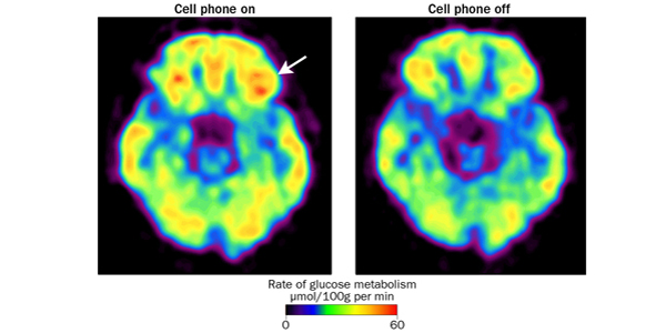 Developer of the soul: Cell Phones May Affect Brain Metabolism