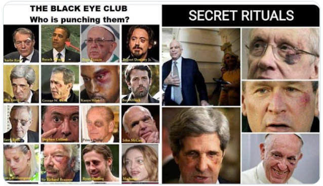 SACH BHARAT: Adrenochrome: “Black Eye Club” Finally Exposed In Detail…
