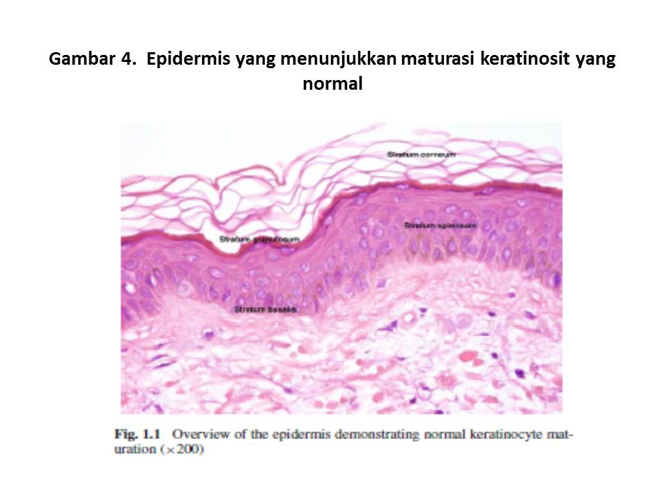 Reza Aditya Digambiro: Histologi Kulit Normal dan Perubahan yang ...