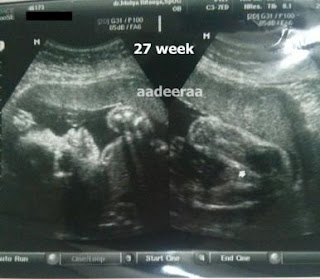 Aku, Kau dan Kita: Hasil USG 2D