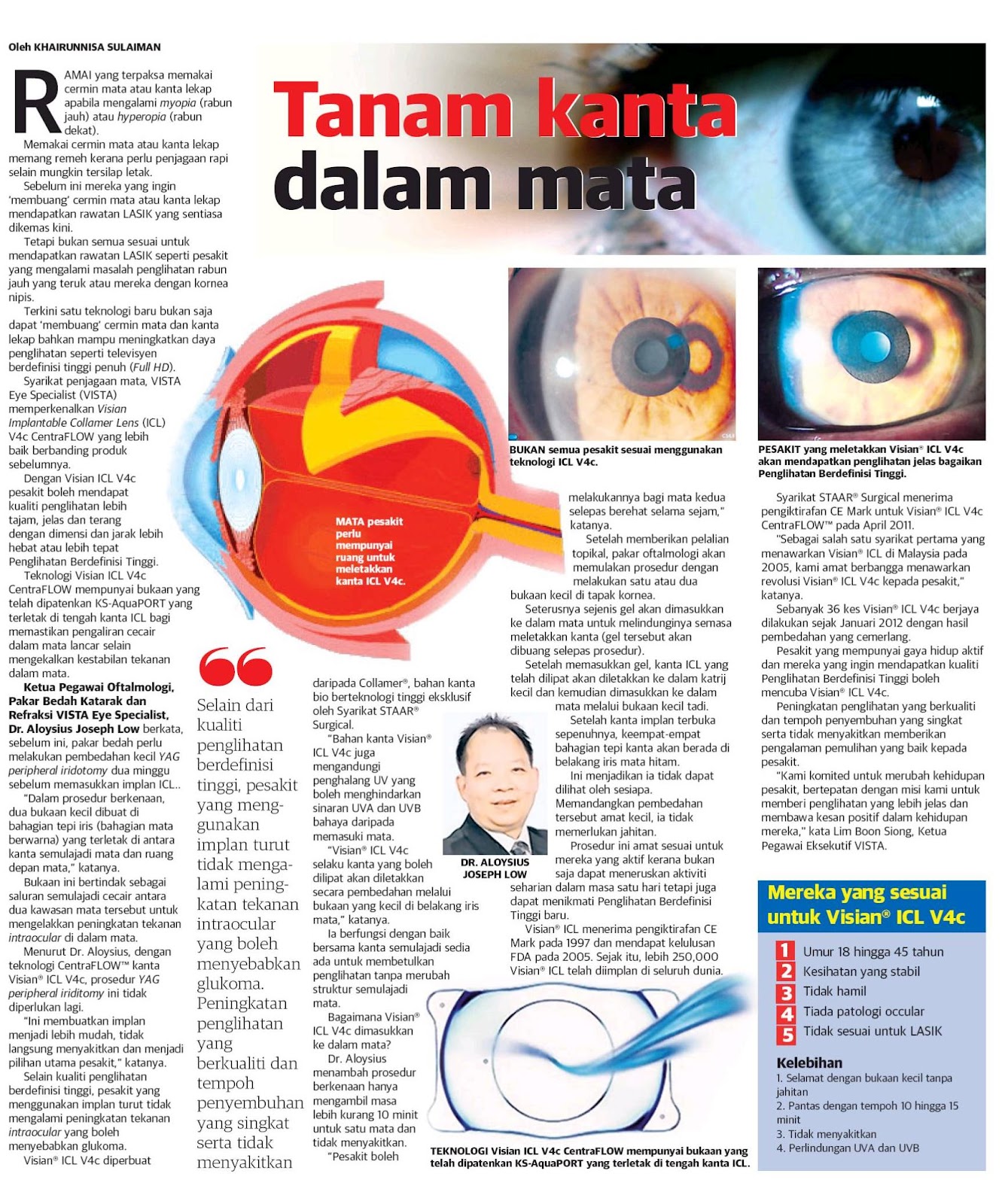 Kaedah Tanam Kanta Dalam Mata ~ SenangEja.com