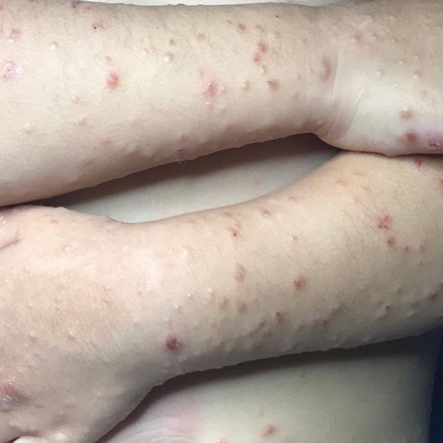 EL RINCÓN DE LA MEDICINA INTERNA. juanpedromacaluso@yahoo.com.ar ...