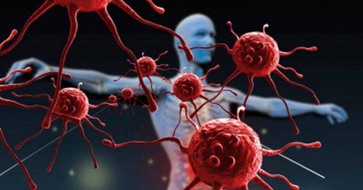 Los nombres de enfermedades (para que lo entienda fácilmente)