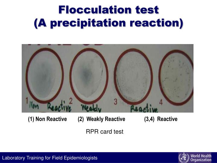 EXAMS AND ME : Precipitation