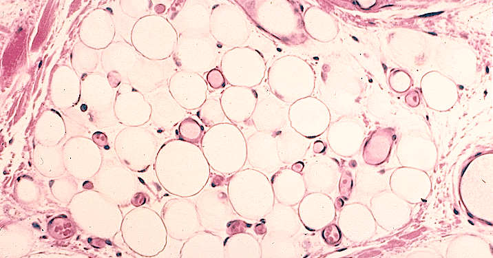 La Mitocondria: Nuestros tejidos IX: Tejido adiposo