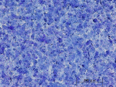 Pramod Dhakal's: Guide for Rat Smear (Diestrus, Proestrus, Estrus and ...