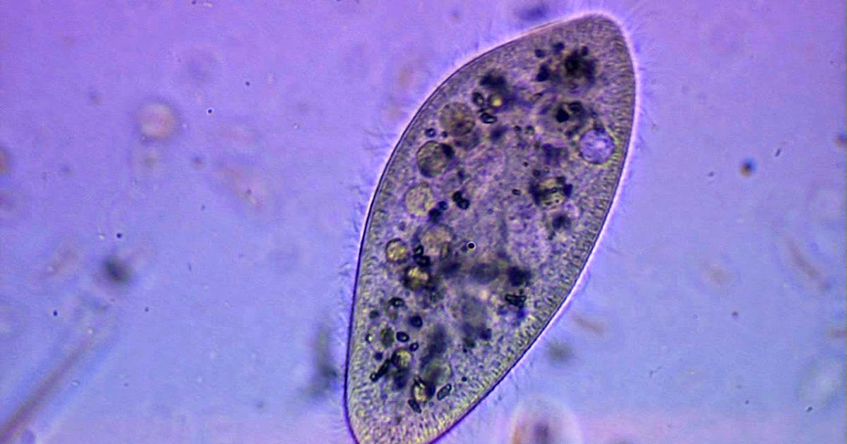 CCNN 2010: 1 ESO: REINO PROTOCTISTA (PROTOZOOS) , y vídeo de Vorticella.