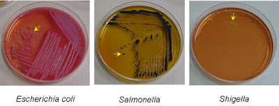 Media Salmonella & Shigella Agar (SSA) ~ Medical Laboratory Technologist