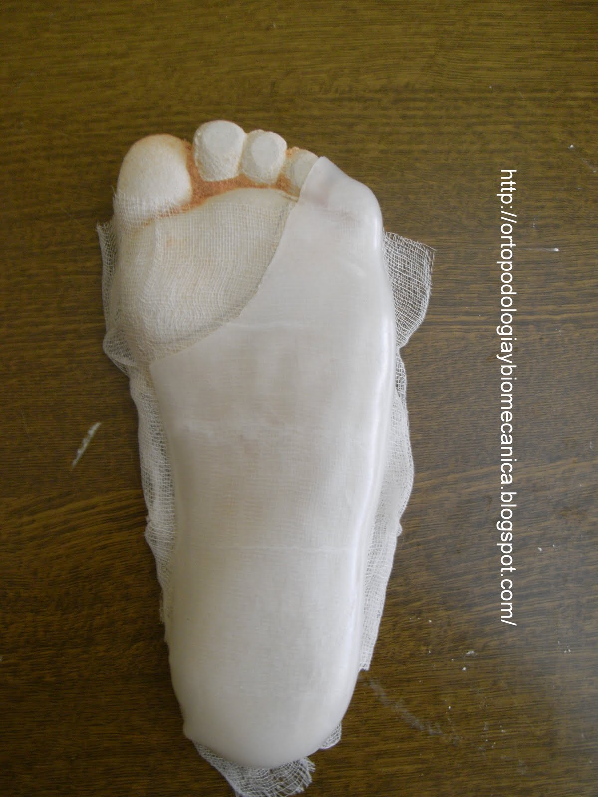 Ortopodologia y Biomecanica : “GAIT PLATE”. TRATAMIENTO METATARSO ADUCTO