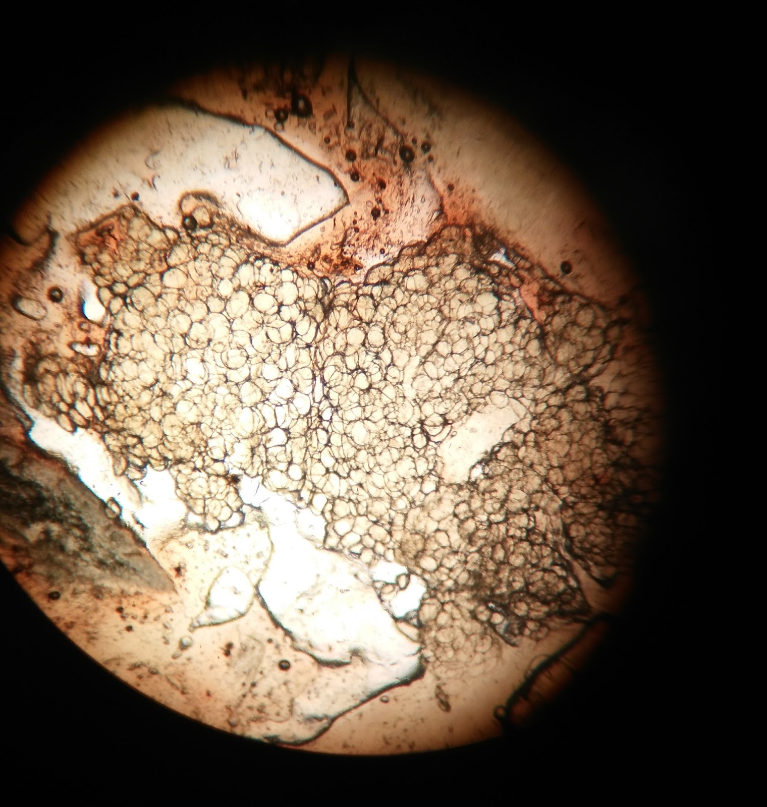 Anatomia Aplicada 1 Bat : PRÀCTICA D'OBSERVACIÓ DE TEIXIT ADIPÓS