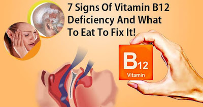 Health Medicine: 7 SIGNS OF VITAMIN B12 DEFICIENCY AND WHAT TO EAT TO ...