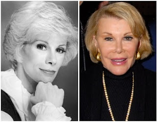 Cosmetic Surgery: Who's Doing What and Where | Gossip Ghirl