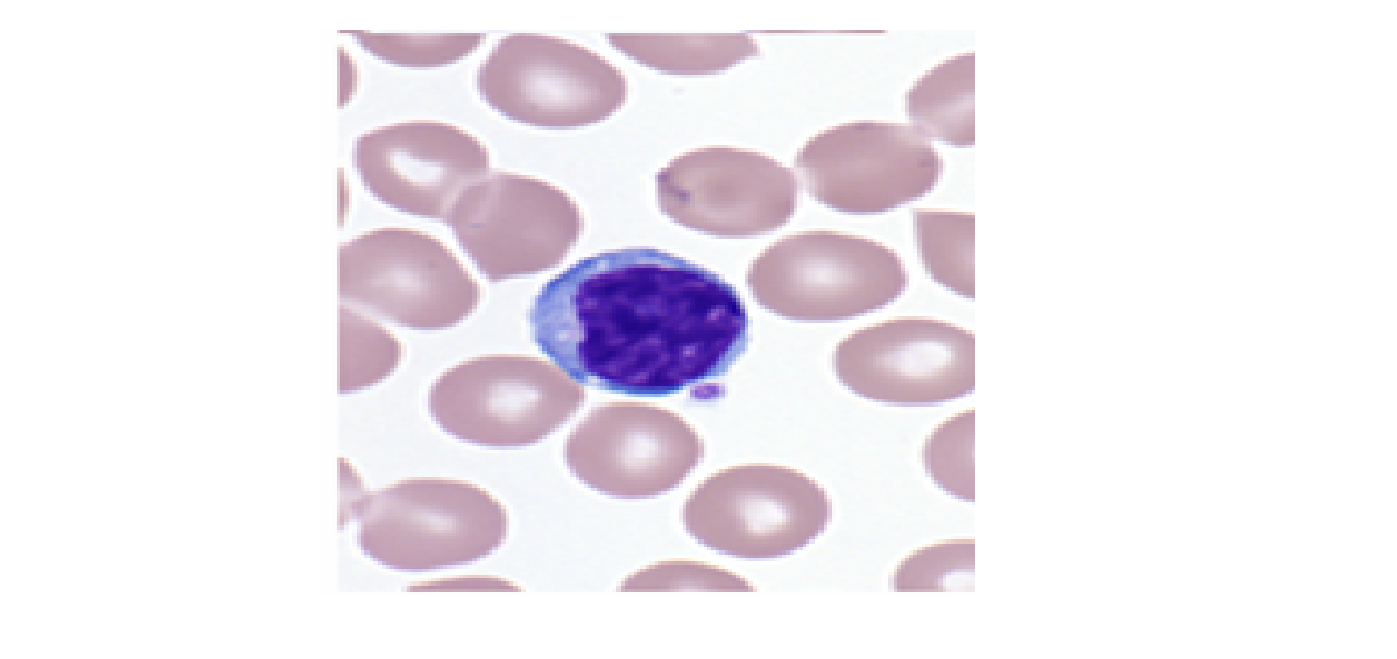 BERBAGI INFO TEKNOLOGI ALAT KESEHATAN: HEMATOLOGI ANALYZER