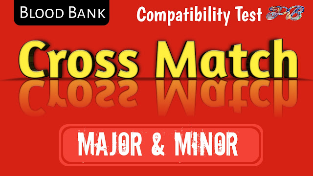 Cross Matching Method New Medical Technology Cross Matching Method New Medical Technology