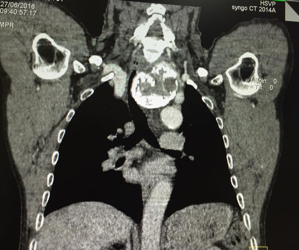 EL RINCÓN DE LA MEDICINA INTERNA. juanpedromacaluso@yahoo.com.ar ...