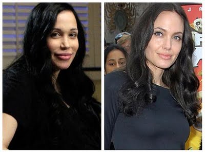 Nadya Suleman Plastic Surgery Before and After Nose Job and Lips - Star ...
